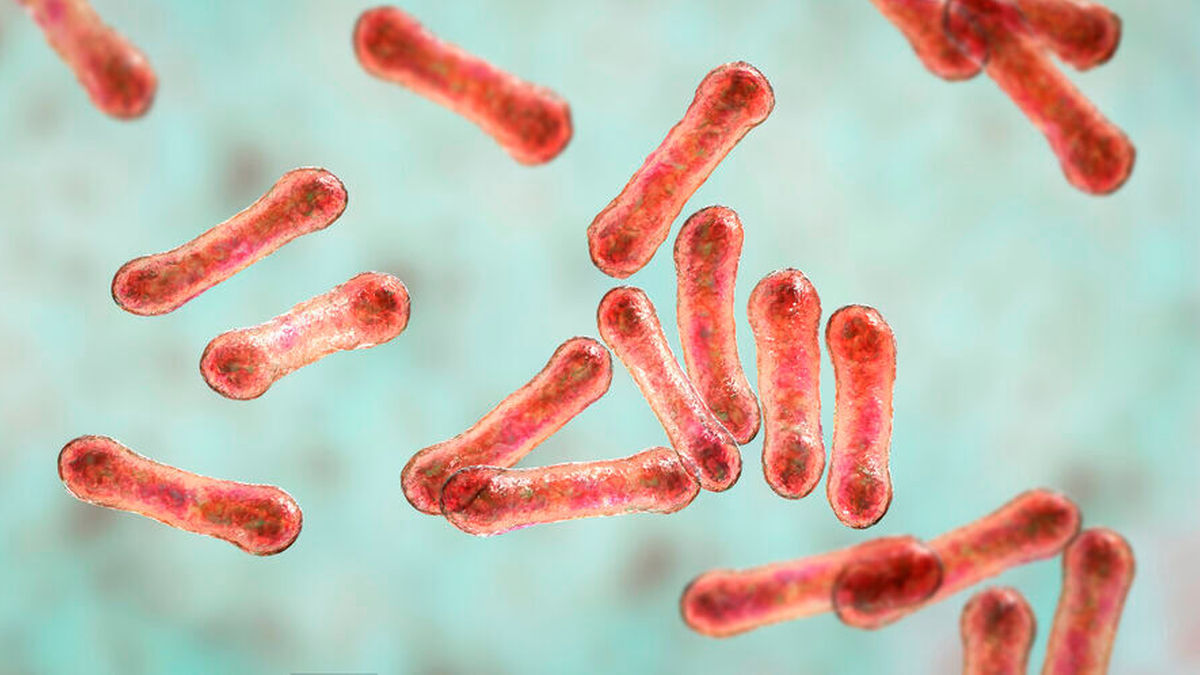 Diphtherie: Anstieg der Fallzahlen in Deutschland