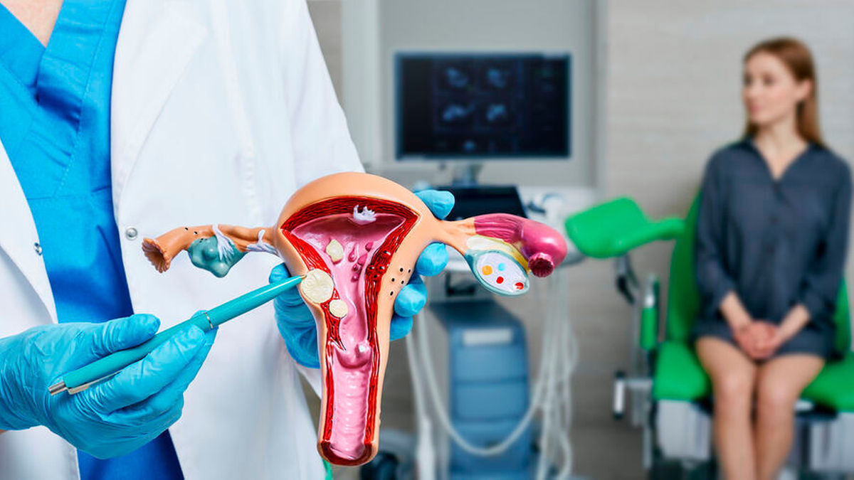 Linzagolix: Individuelle Myomtherapie mit oder ohne ABT