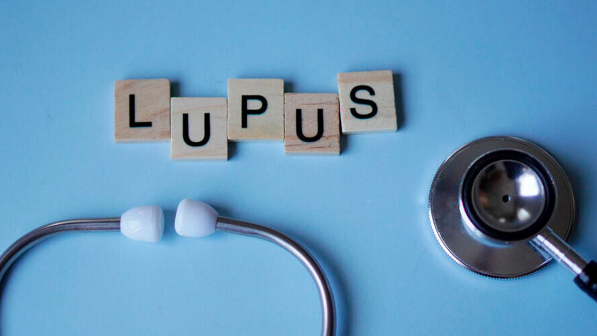 Dapirolizumab Pegol: Wirksamkeit bei SLE bestätigt