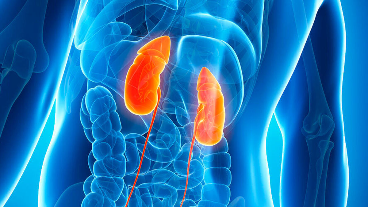 Finerenon bei CKD in Verbindung mit Typ-2-Diabetes