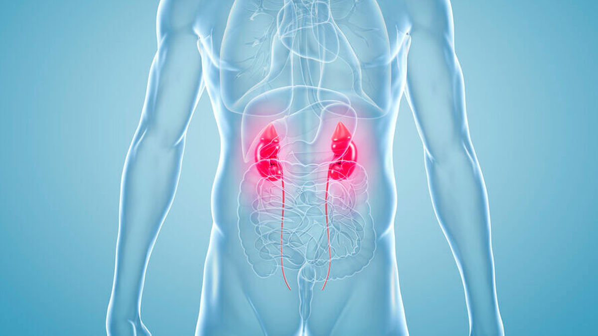 Finerenon: Indikationserweiterung bei CKD mit T2D