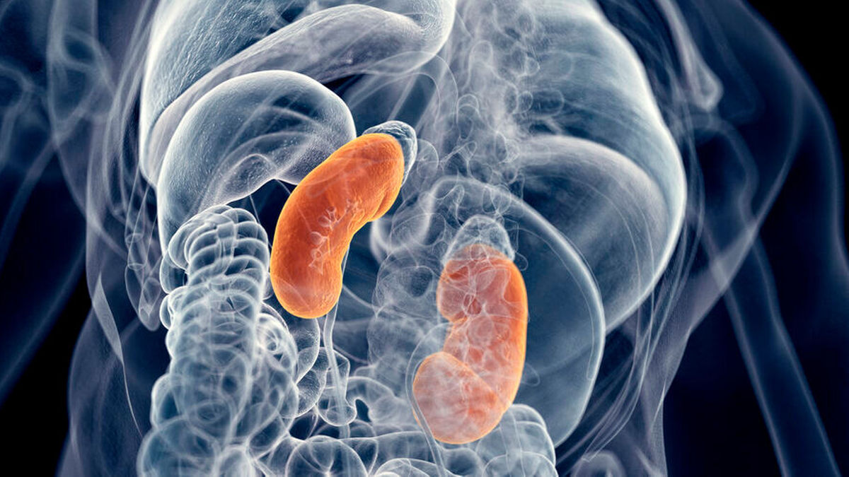 Finerenon bei chronischer Nierenerkrankung + T2D