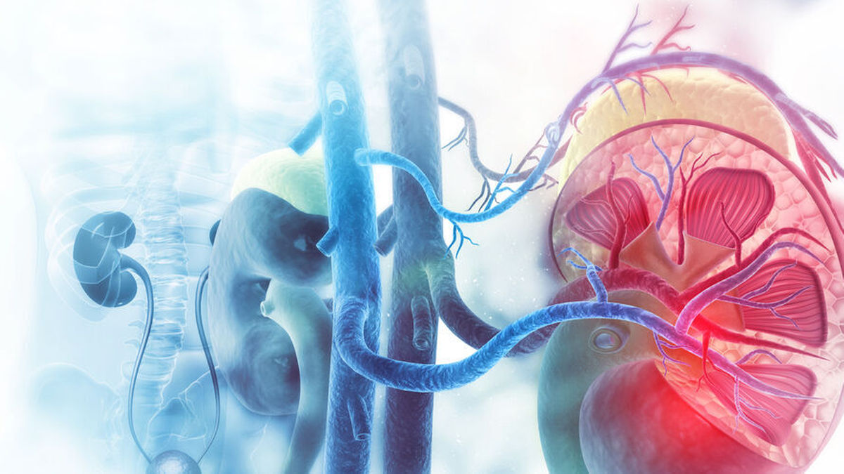 Finerenon bei CKD und T2D