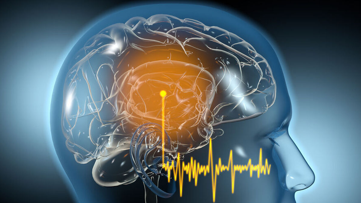 S3-Leitlinie zu Tinnitus aktualisiert