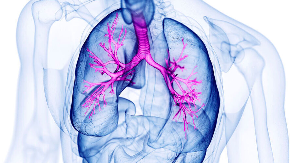 COPD: Sind Kategorien wie Pink Puffer und Blue Bloater noch aktuell?