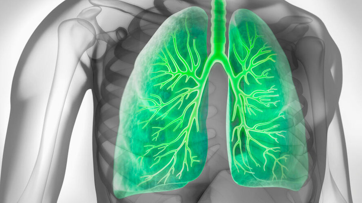 COPD: Eine neue Dreifach-Kombination bei Atemnot?