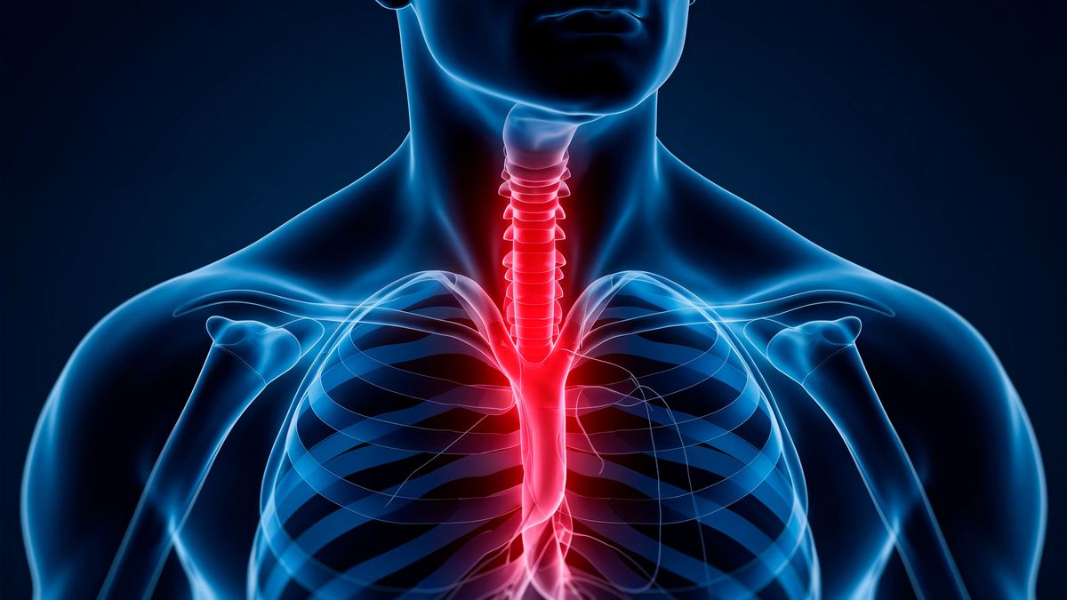 Eosinophile Ösophagitis